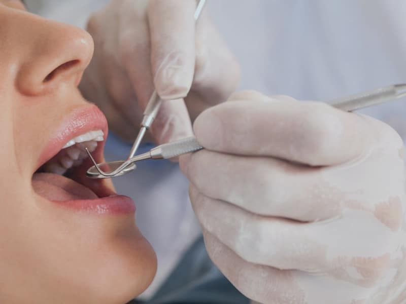 Apicoectomy Endodontic Procedure by Arrowhead Glendale Dentist