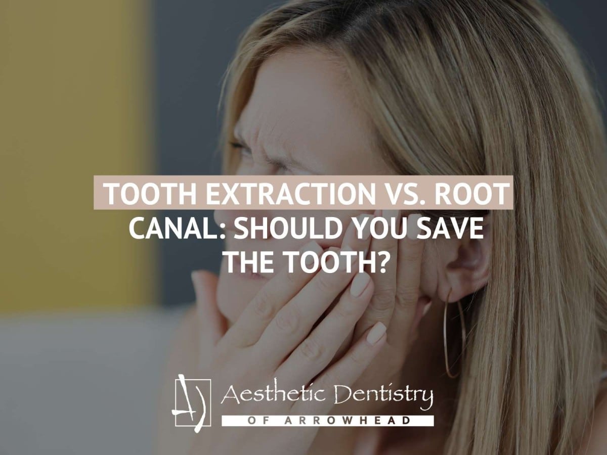 Tooth Extraction Vs. Root Canal: Should You Save The Tooth?